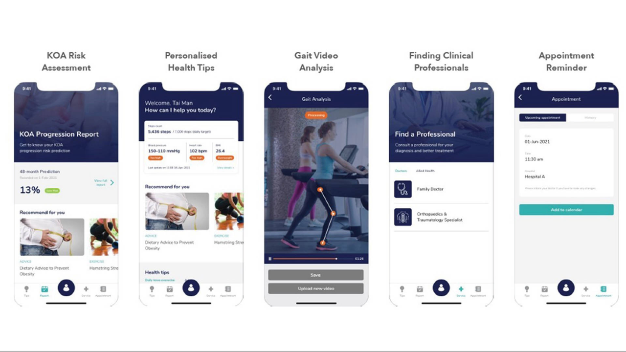 AI flags up knee osteoarthritis | Article – HSBC Business Go